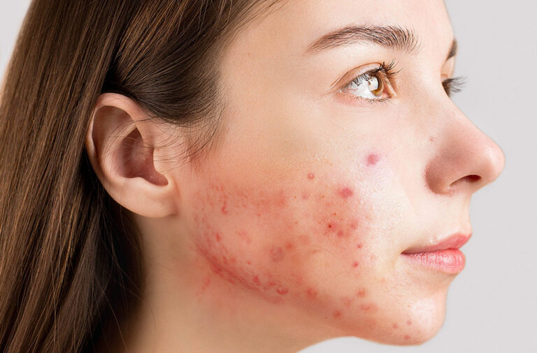Chattanooga Dermatologists | The Derm Center